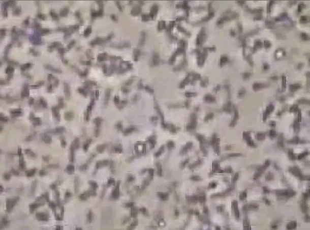 sperm under microscope gif
