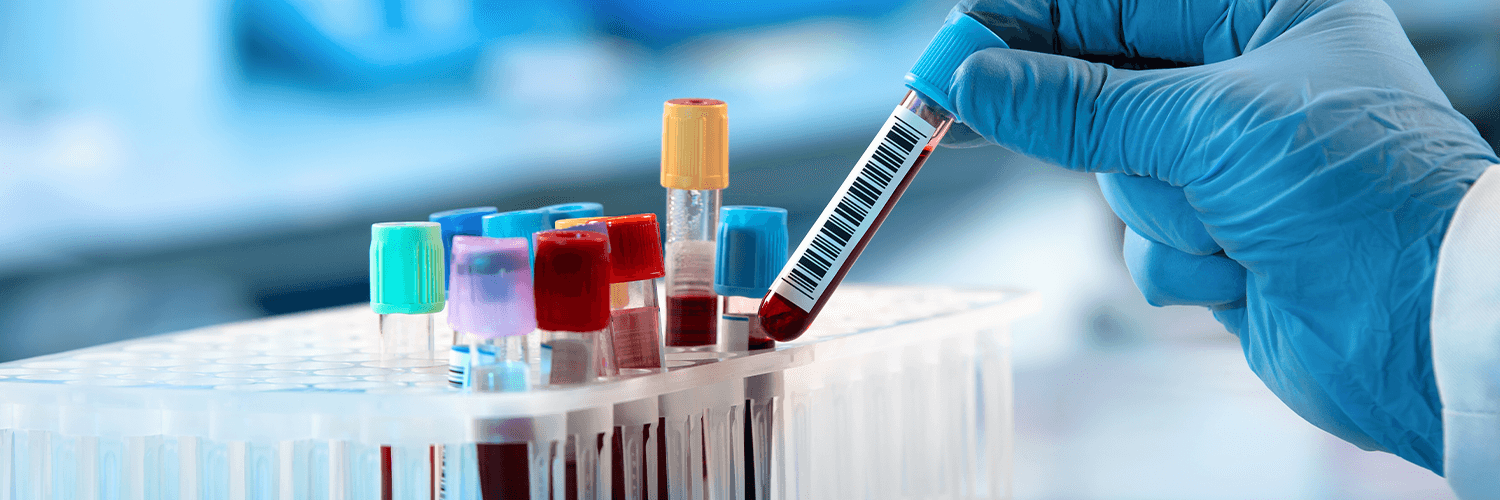 forensic_toxicology-hero.png | National Institute of Justice