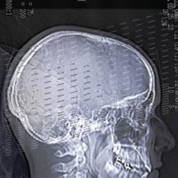 Using Advanced Imaging Technologies to Enhance Autopsy Practices ...