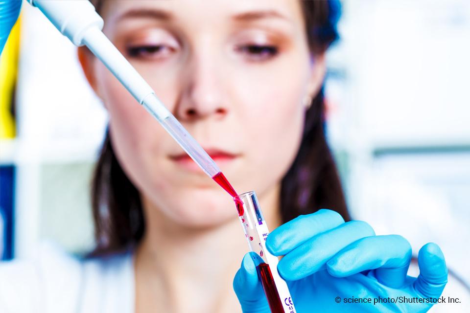 lab technician using dropper to add red liquid to a test tube card ...